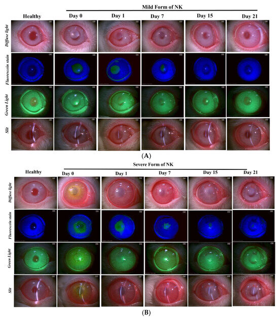Chemical (Alkali) Burn-Induced Neurotrophic Keratitis Model in New ...