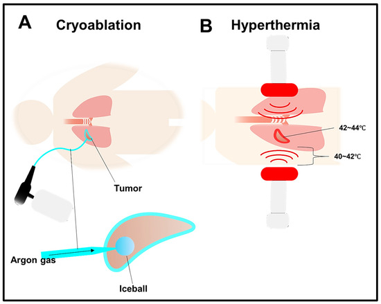Cells | Free Full-Text | Cutting-Edge Therapies for Lung Cancer