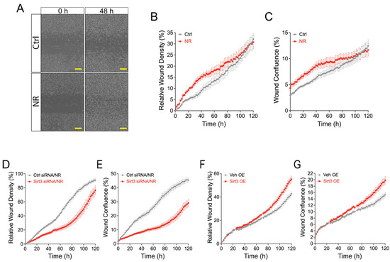 Nicotinamide Riboside Augments Human Macrophage Migration via SIRT3 ...