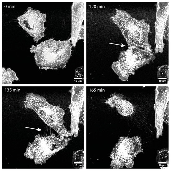 High-Resolution Microscopic Characterization of Tunneling Nanotubes in ...