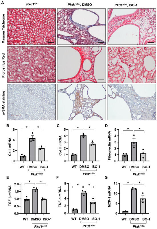 Cells | Free Full-Text | CD74 Promotes Cyst Growth and Renal Fibrosis ...