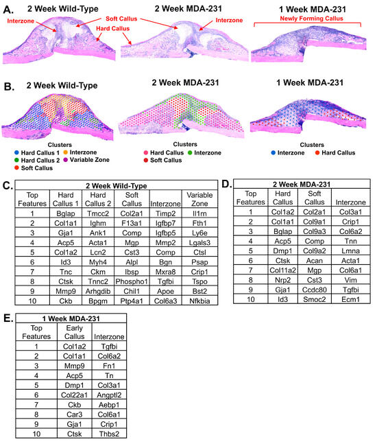 Unique Spatial Transcriptomic Profiling of the Murine Femoral Fracture ...