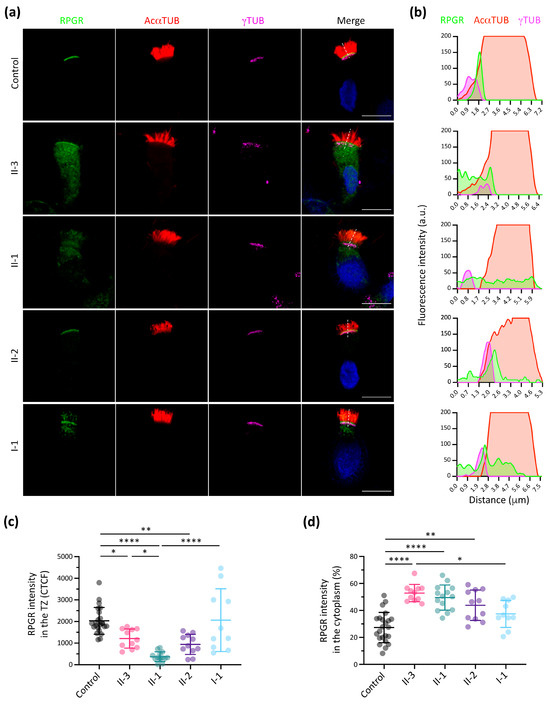 Primary Ciliary Dyskinesia and Retinitis Pigmentosa: Novel RPGR Variant ...