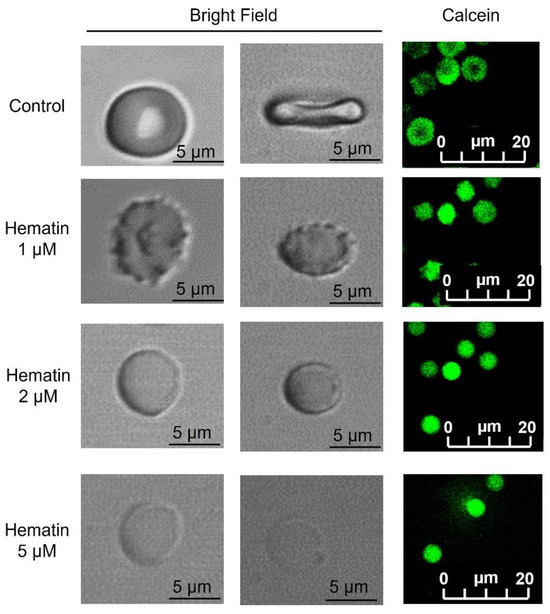 Hematin- and Hemin-Induced Spherization and Hemolysis of Human ...