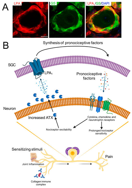 Satellite Glial Cells in Human Disease