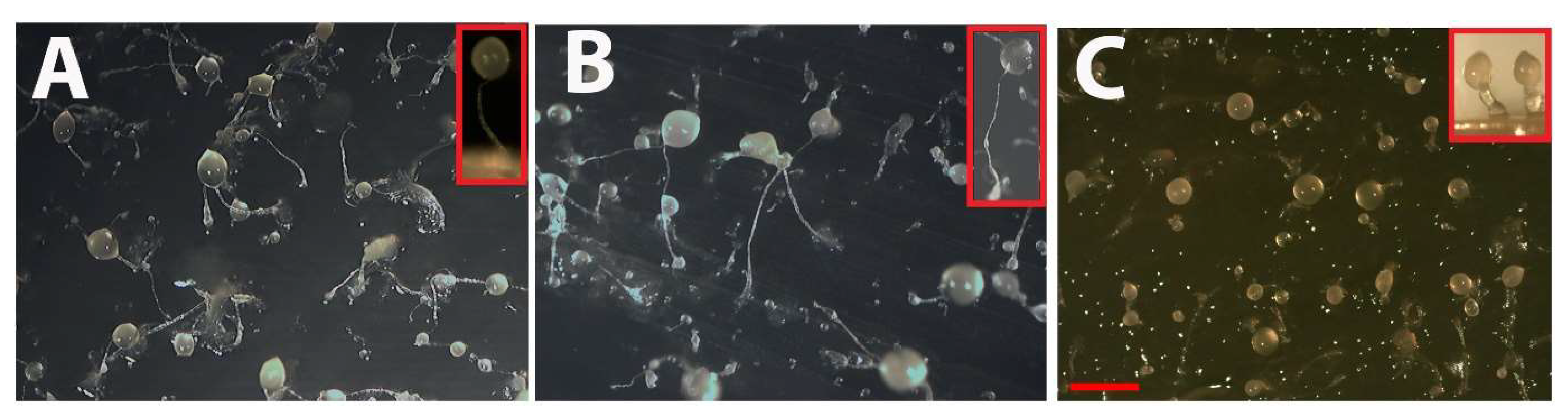 Polycystin-2 Mediated Calcium Signalling in the Dictyostelium Model for ...