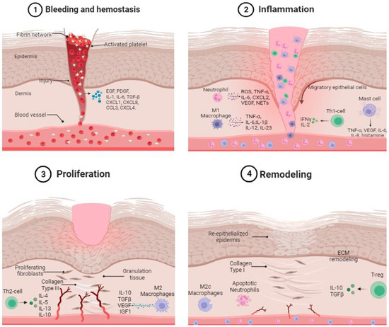 Role of the Skin Immune System in Wound Healing