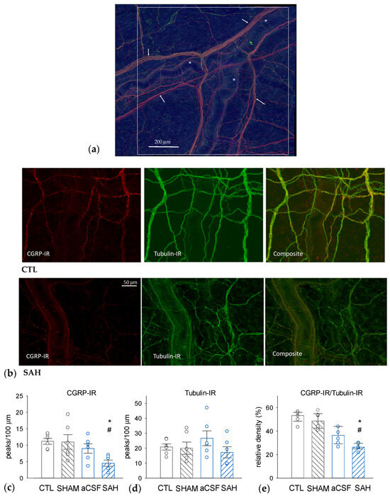 Subarachnoid Hemorrhage Depletes Calcitonin Gene-Related Peptide Levels ...