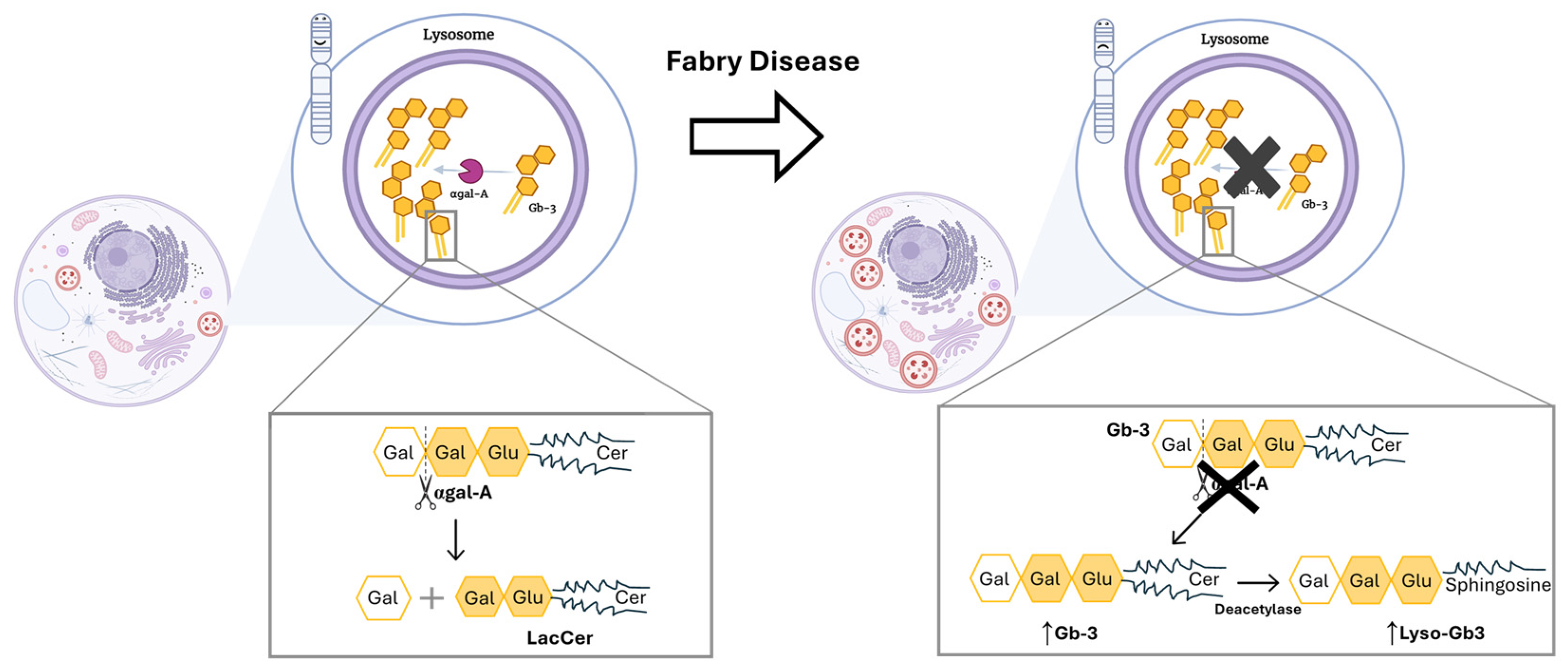 Cells | Free Full-Text | Inflammation and Exosomes in Fabry Disease ...