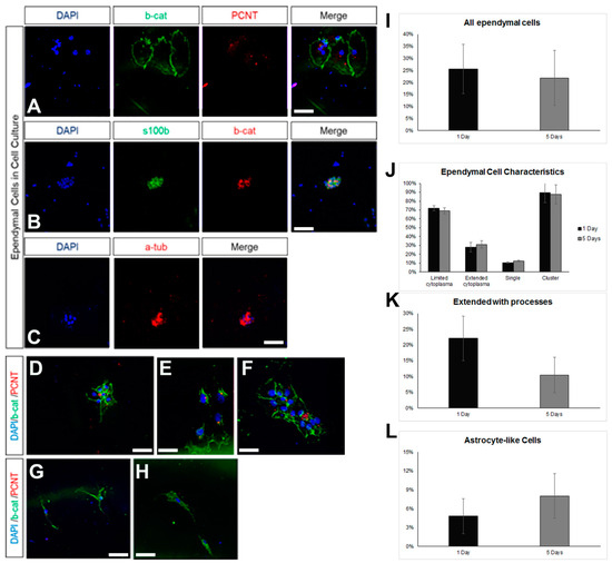 Reversal of Postnatal Brain Astrocytes and Ependymal Cells towards a ...