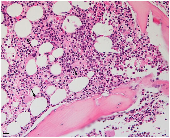 Cells Free Full Text Bone Marrow Adipose Tissue