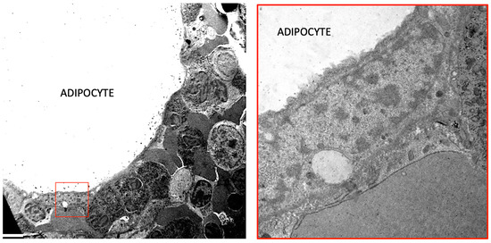 Cells Free Full Text Bone Marrow Adipose Tissue