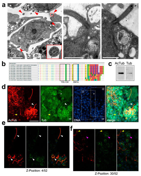 Transient Interphase Microtubules Appear in Differentiating Sponge Cells