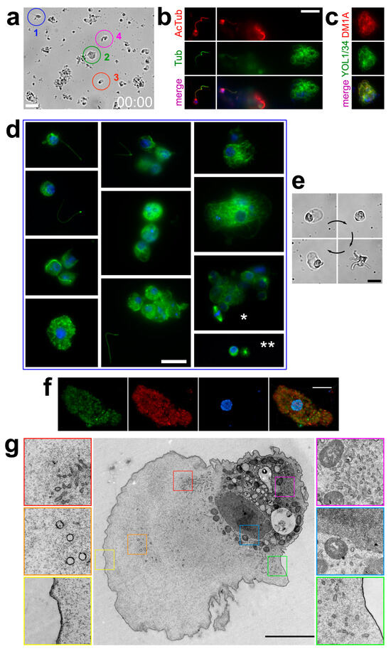 Transient Interphase Microtubules Appear in Differentiating Sponge Cells