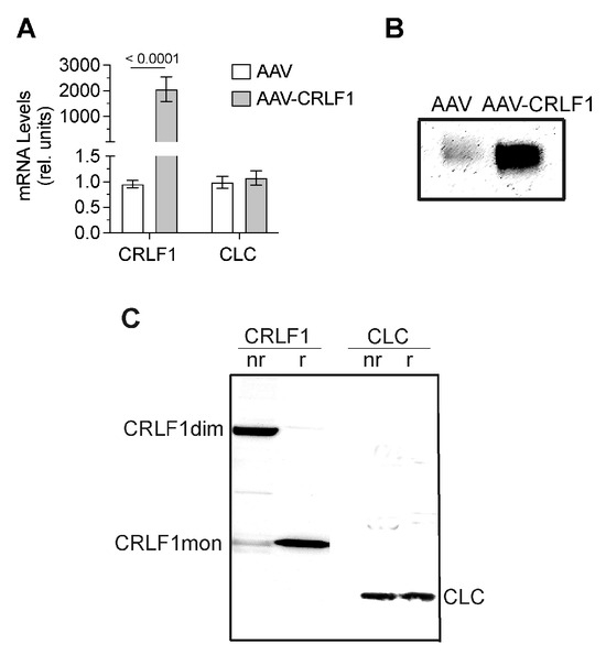 Cytokine Receptor-like Factor 1 (CRLF1) and Its Role in Osteochondral ...
