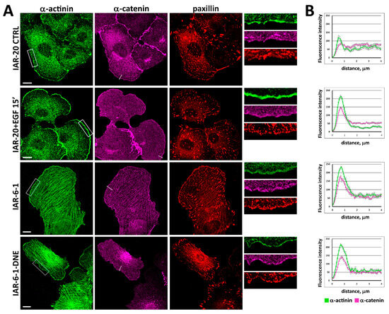 Actin Cytoskeleton Remodeling Accompanied by Redistribution of Adhesion ...