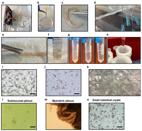 Isolation of Myenteric and Submucosal Plexus from Mouse ...