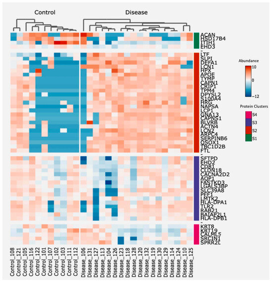 Cells | Free Full-Text | Altered Extracellular Vesicle-Derived Protein and microRNA Signatures ...
