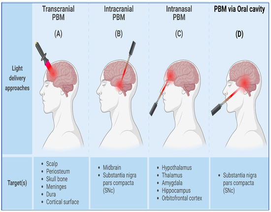 Photobiomodulation Therapy on Brain: Pioneering an Innovative Approach to Revolutionize ...