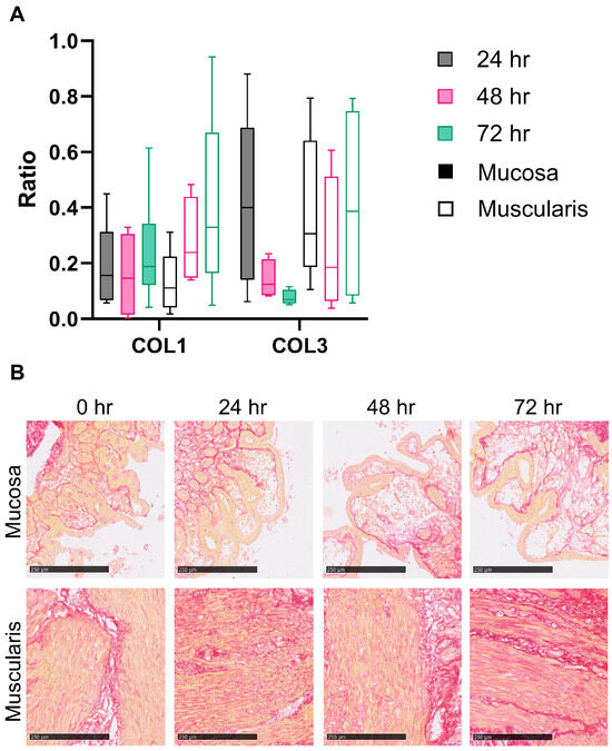 Cells | Free Full-Text | Fibrogenesis in Human Mucosa and Muscularis ...