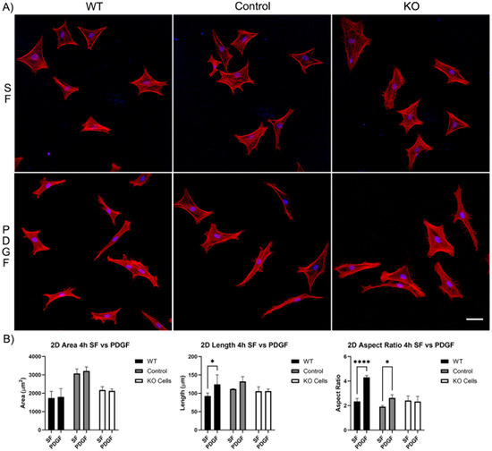 The Role of Vimentin in Human Corneal Fibroblast Spreading and ...
