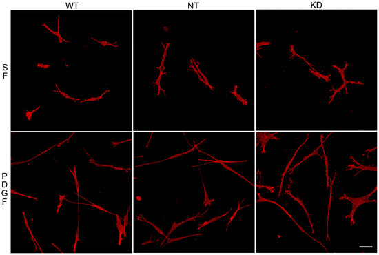 The Role of Vimentin in Human Corneal Fibroblast Spreading and ...