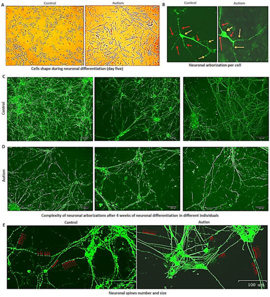 iPSC-Derived Astrocytes and Neurons Replicate Brain Gene Expression ...