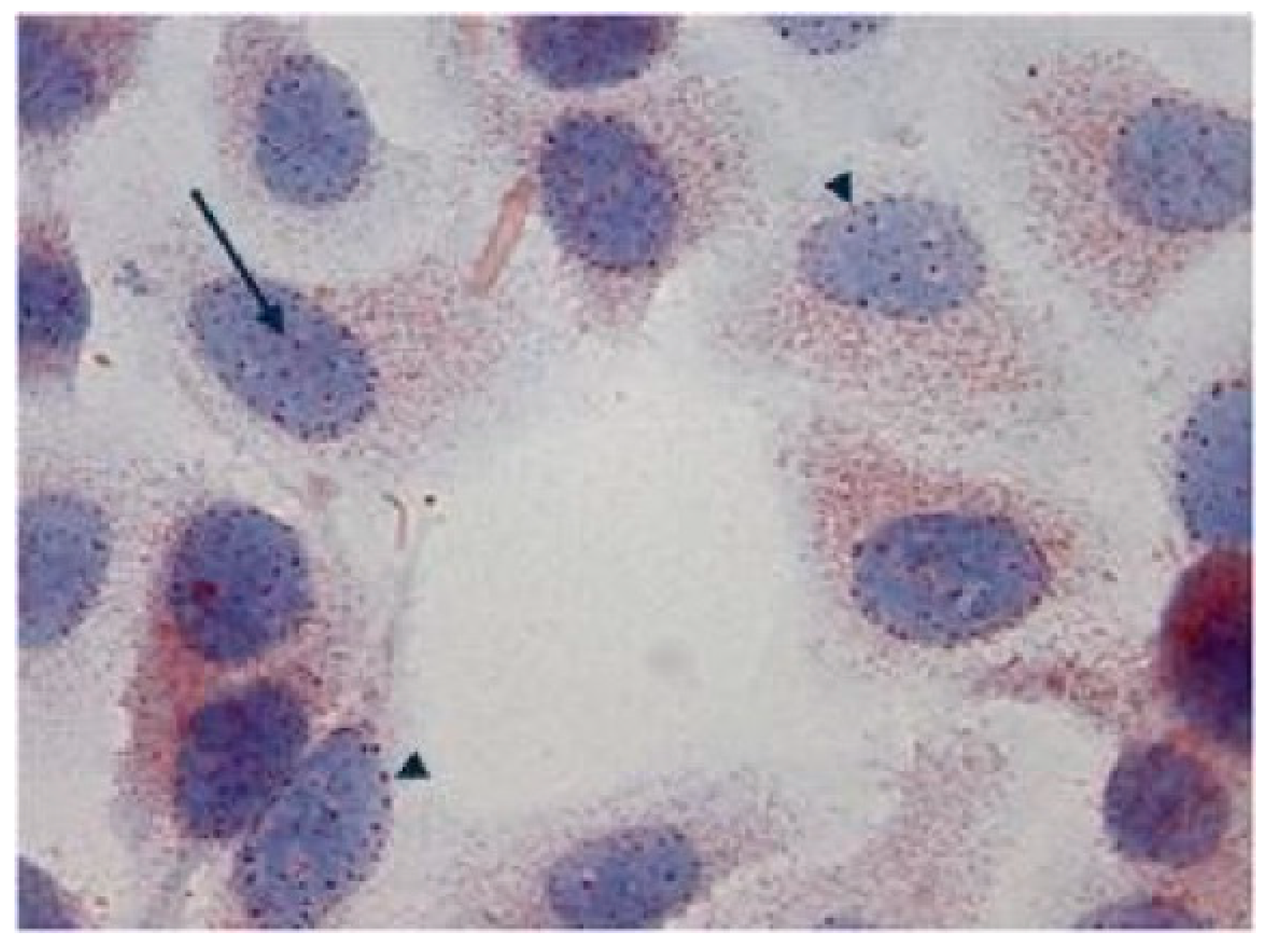 Thymosin β4 and β10 Expression in Human Organs during Development: A Review