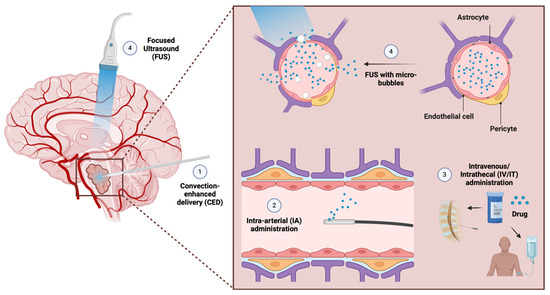 H3K27-Altered Diffuse Midline Glioma of the Brainstem: From Molecular ...