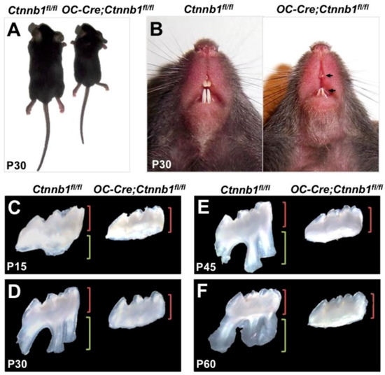 Advances in Regenerative Dentistry: A Systematic Review of Harnessing ...