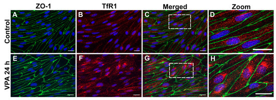 Upregulation of Transferrin Receptor 1 (TfR1) but Not Glucose ...