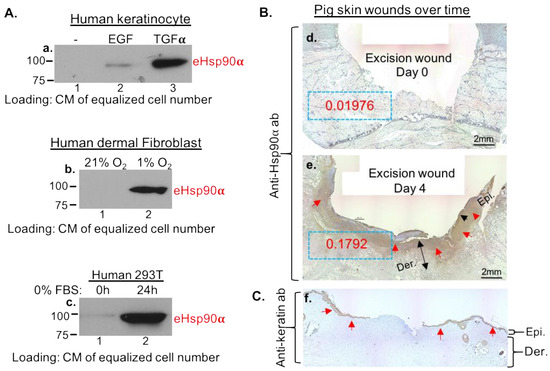 Cells | Free Full-Text | Discovery of Cell Number-Interstitial Fluid ...