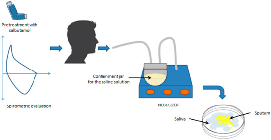 Breath and Sputum Analyses in Asthmatic Patients: An Overview