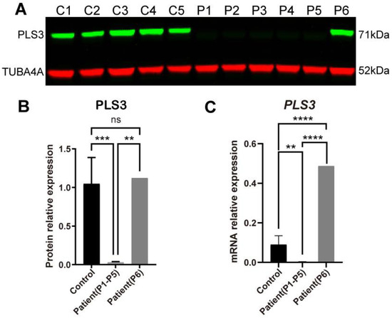 Functional Insights in PLS3-Mediated Osteogenic Regulation