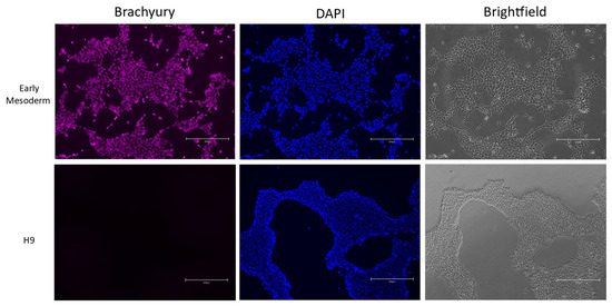 Alternative Ways to Obtain Human Mesenchymal Stem Cells from Embryonic ...