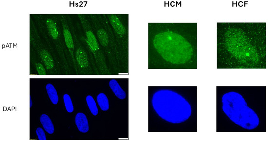 Accelerated Aging Effects Observed In Vitro after an Exposure to Gamma ...