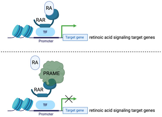 The Utilization of PRAME in the Diagnosis, Prognosis, and Treatment of Melanoma
