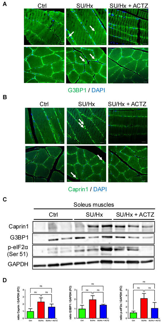 Stress Granule Assembly in Pulmonary Arterial Hypertension