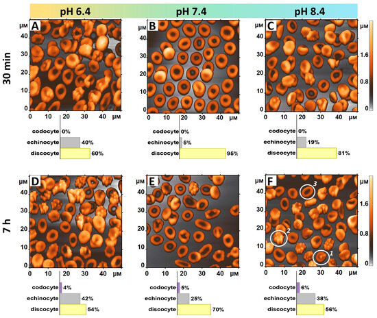 The Effect of the Acid-Base Imbalance on the Shape and Structure of Red ...