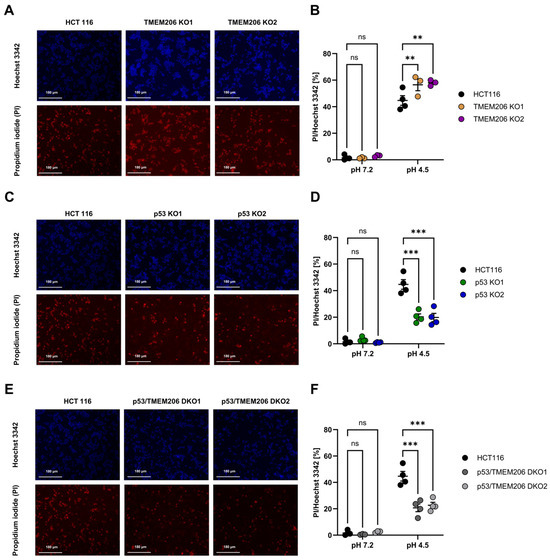 TMEM206 Contributes to Cancer Hallmark Functions in Colorectal Cancer ...