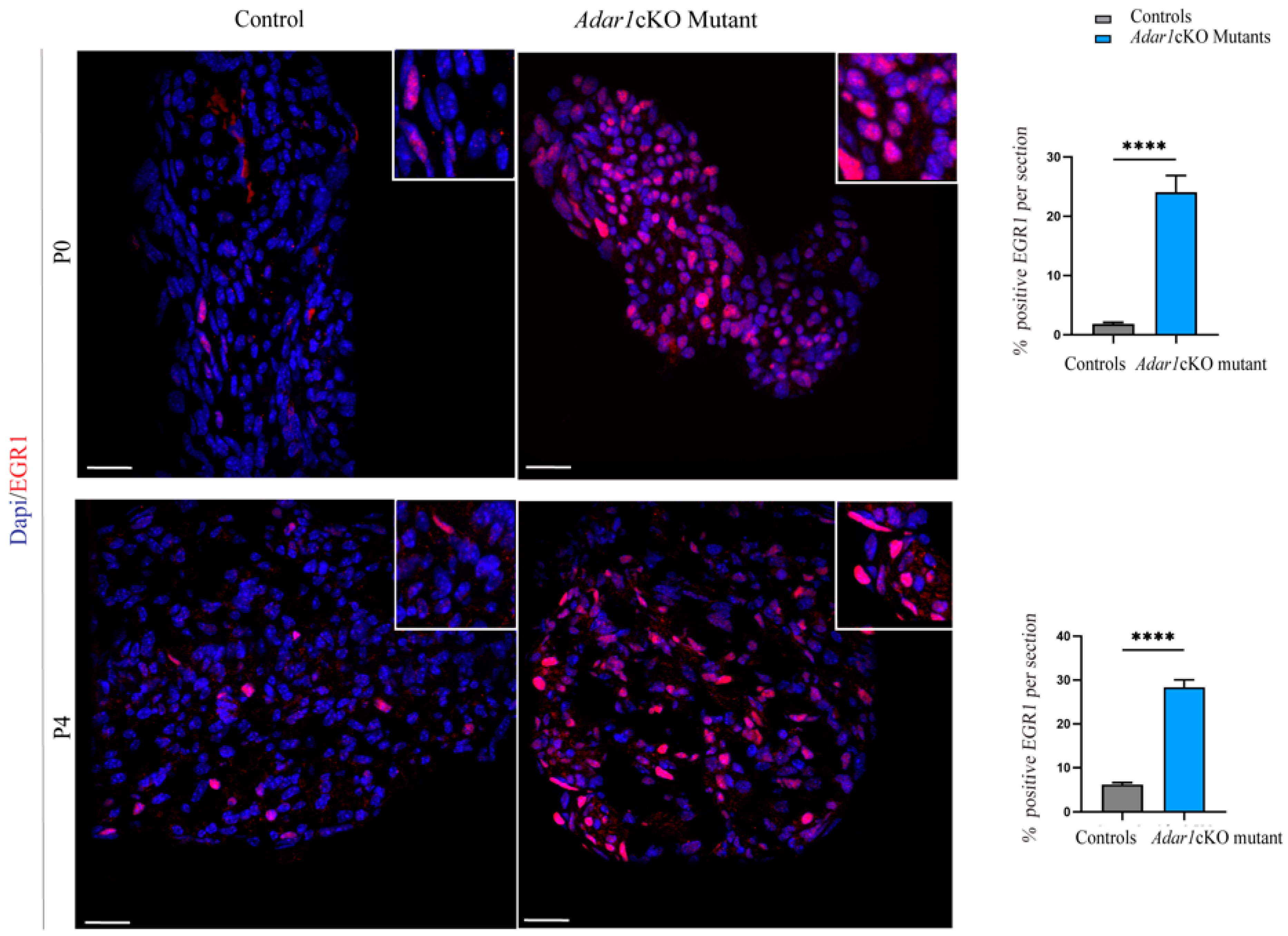 Overexpression of Egr1 Transcription Regulator Contributes to Schwann ...