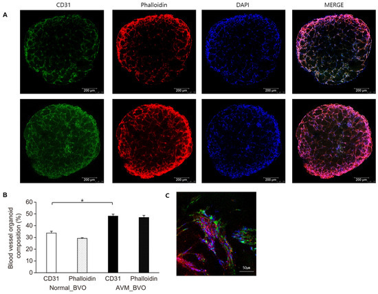 The Formation of Human Arteriovenous Malformation Organoids and Their ...