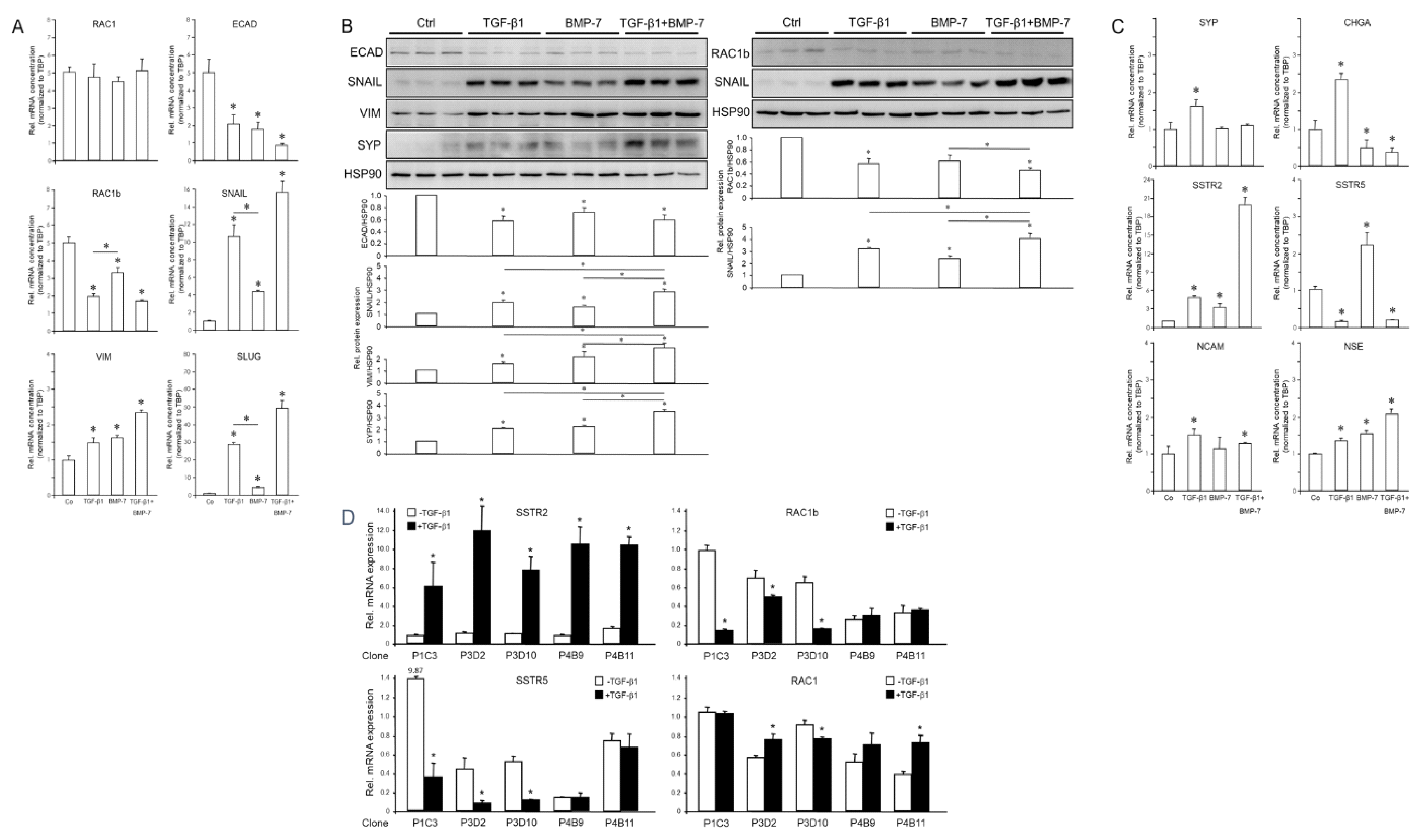 Characterization of Epithelial–Mesenchymal and Neuroendocrine ...