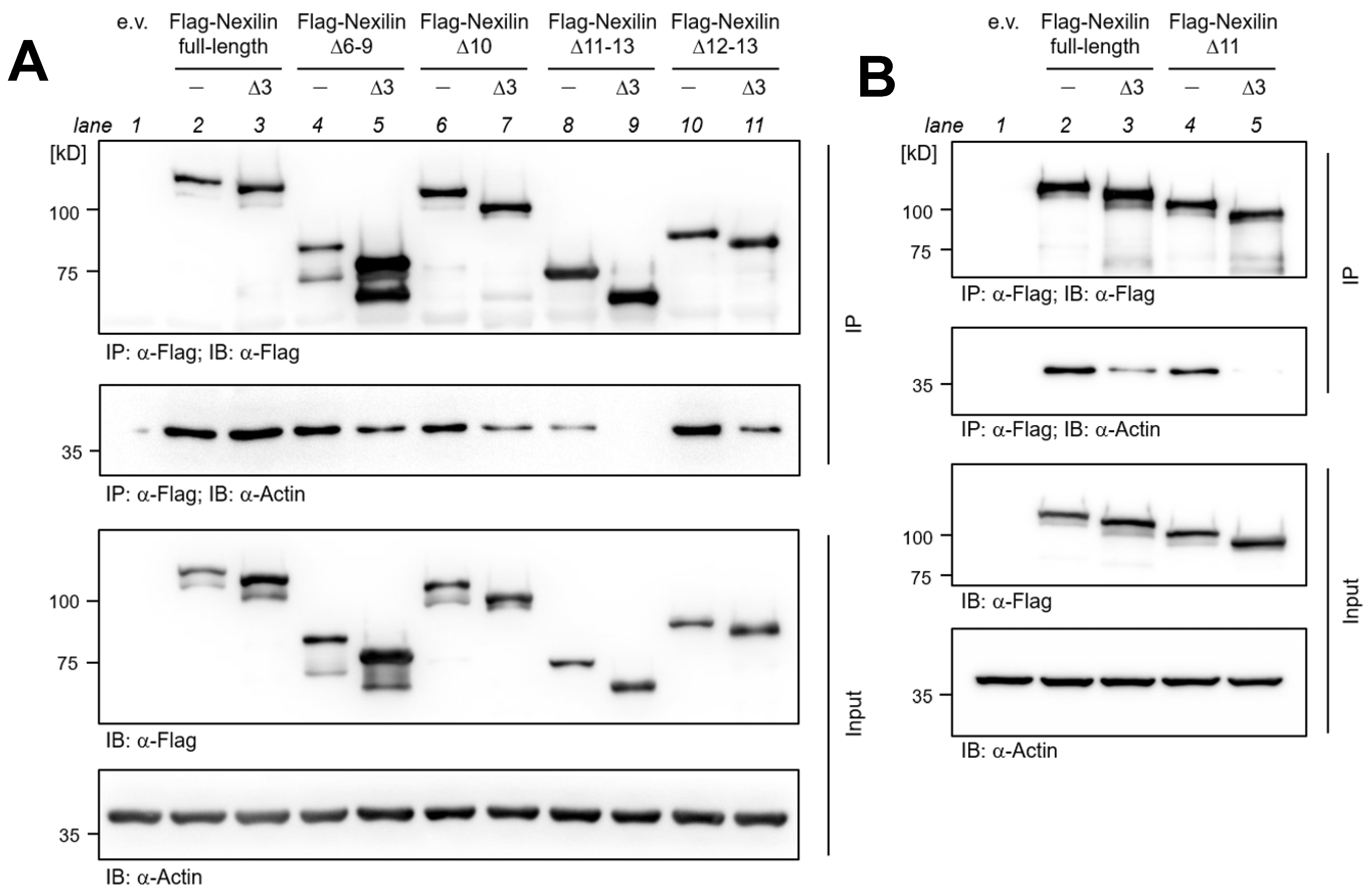 Identification of Novel Nexilin Splice Variants in Mouse and Human Tissues