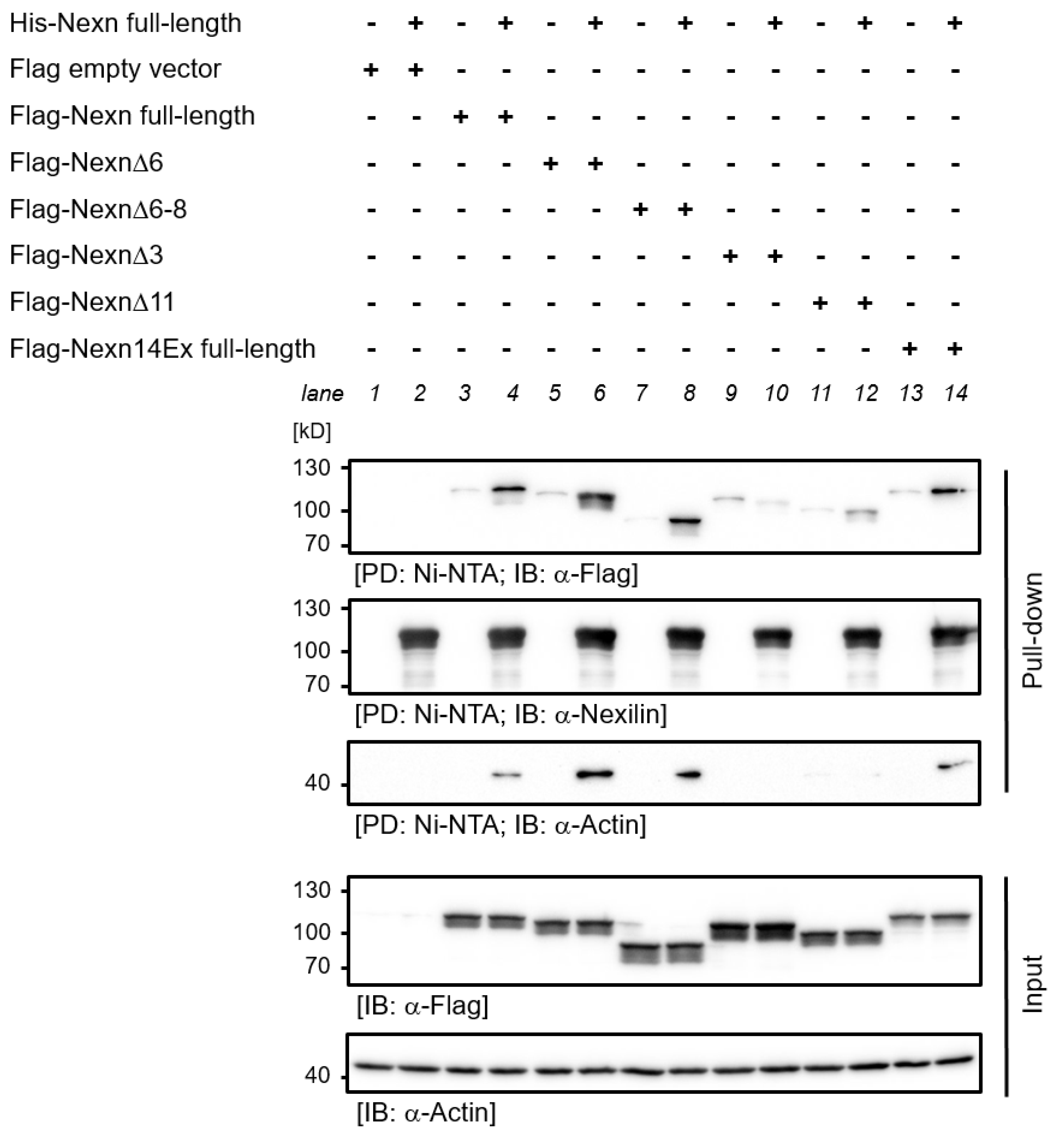 Identification of Novel Nexilin Splice Variants in Mouse and Human Tissues