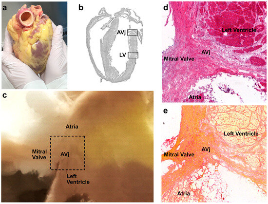 Stem Cell-Associated Proteins and Extracellular Matrix Composition of ...