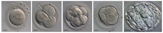 Molecular Markers in Embryo Non-Development: Analysis of Gene ...