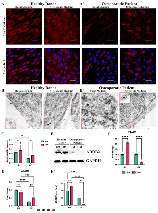 Unraveling the Mechanism of Impaired Osteogenic Differentiation in ...