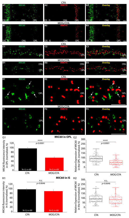 Early Synapse-Specific Alterations of Photoreceptor Mitochondria in the ...