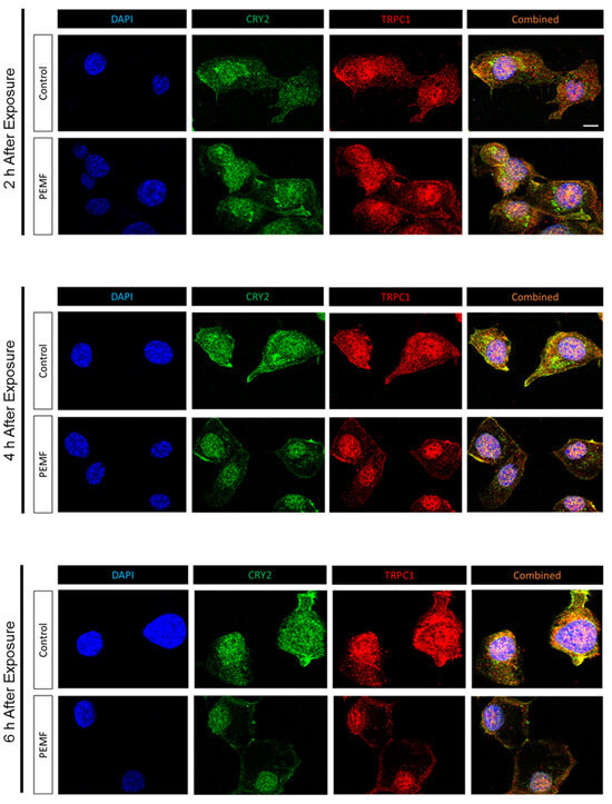 Magnetically Stimulated Myogenesis Recruits a CRY2-TRPC1 Photosensitive ...